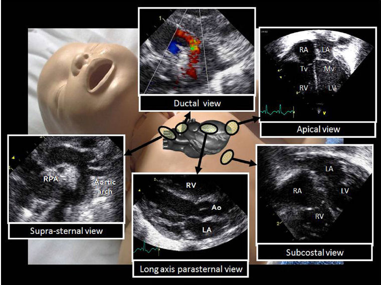 Ecocardio Funcional ElKhuffash_2011